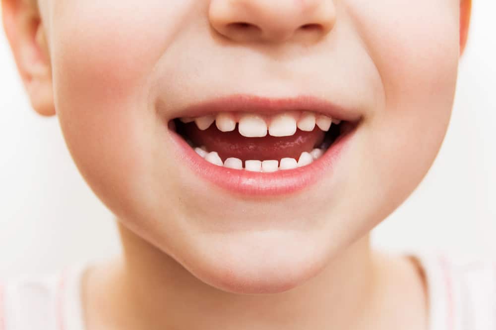Why Do Kids Have Baby Teeth? - Carlingwood Dental Centre